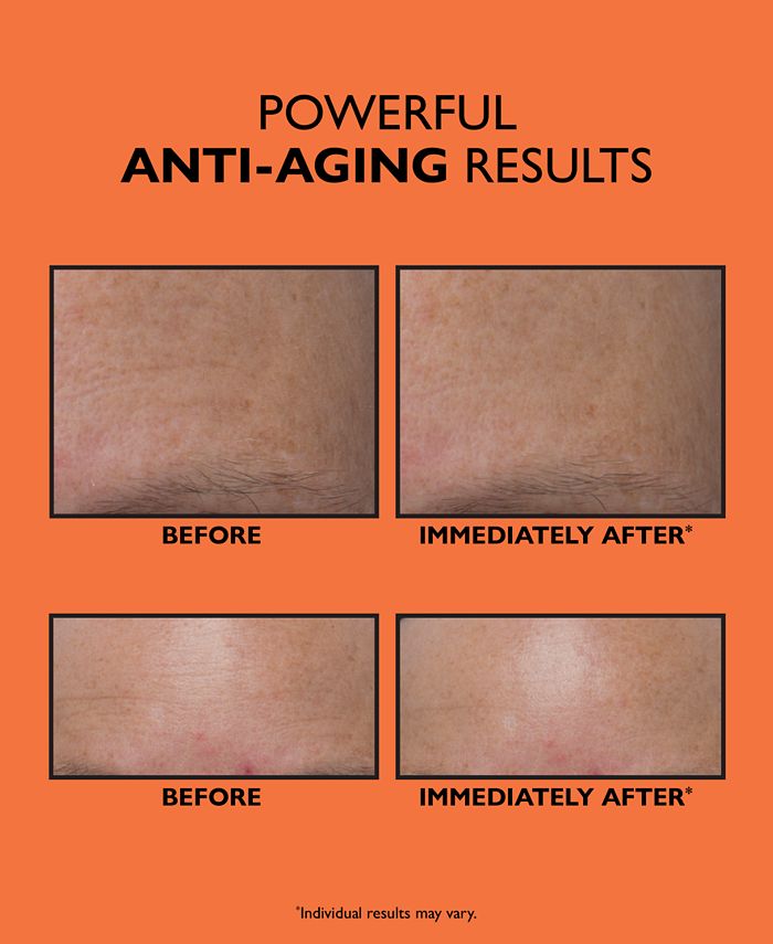 Peter Thomas Roth Anti-Aging Triple Acid Peel - Macy's