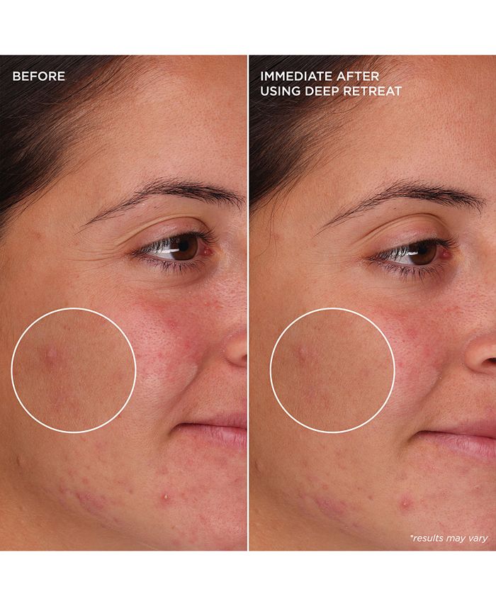 Benefit Cosmetics The POREfessional Deep Retreat Pore-Clearing Clay ...