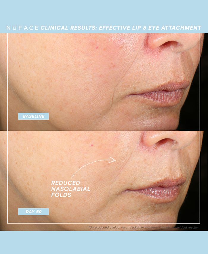 NuFACE Effective Lip & Eye Attachment - Macy's