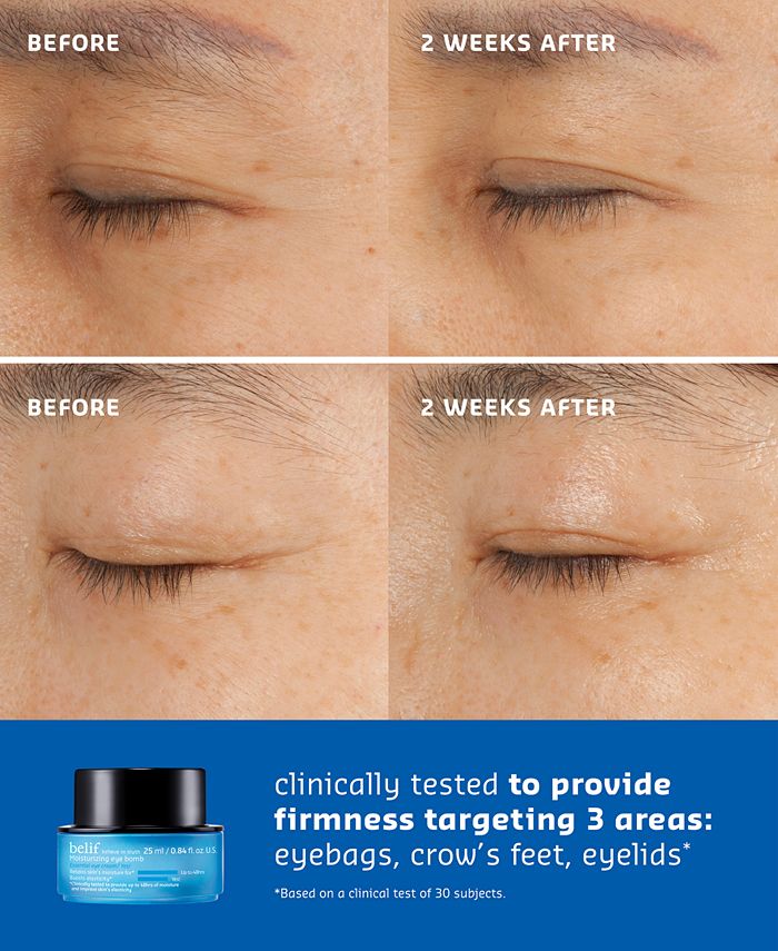 Belif Moisturizing Eye Bomb With Peptide, Ceramide & Squalane, 0.84 oz ...