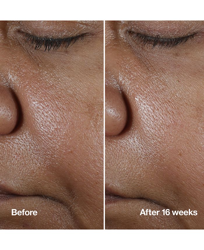 Clinique Smart Clinical Repair™ Wrinkle Correcting Serum, 3.4 oz. - Macy's