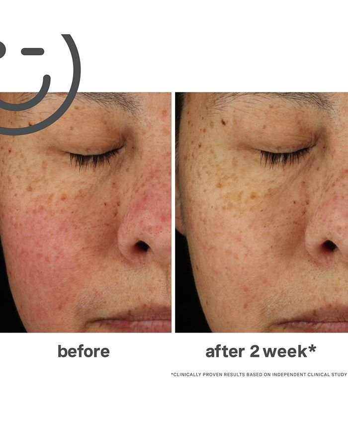 KATE SOMERVILLE KateCeuticals Total Repair Cream, 1 oz. - Macy's