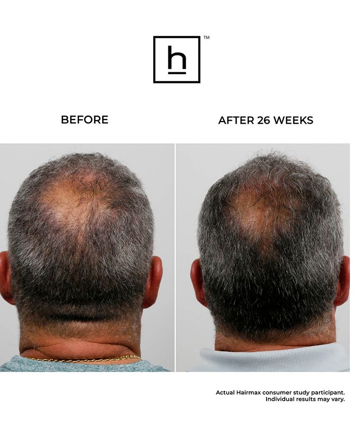 Hairmax Ultima 12 Lasercomb - Macy's