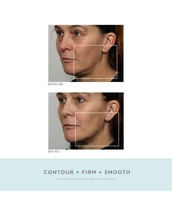 NuFACE 5-Pc. Trinity Supercharged Set - Macy's