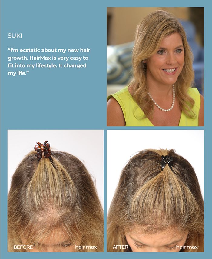 Hairmax Laserband 41 Comfortflex - Macy's