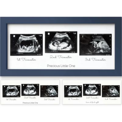 KeaBabies Trio Baby Sonogram Picture Frame, Baby Ultrasound Picture ...