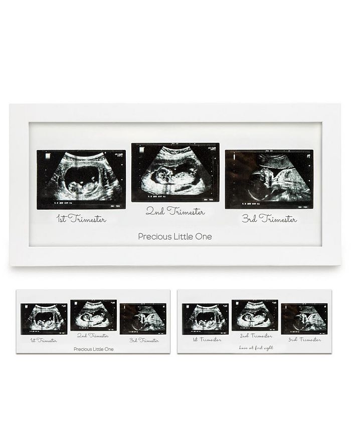 KeaBabies Sonogram Picture Frame - Trio Ultrasound Picture Frames For ...