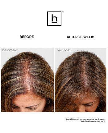 Hairmax Ultima 12 Lasercomb - Macy's