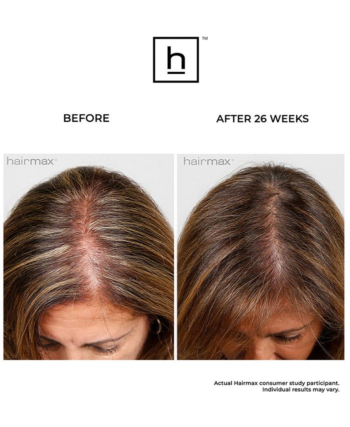 Hairmax Ultima 12 Lasercomb - Macy's