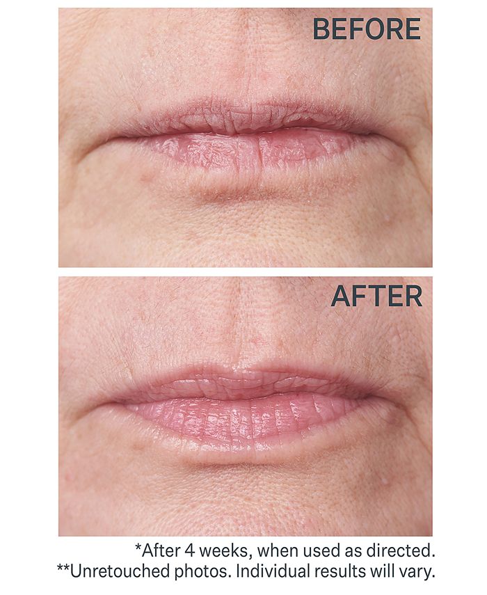 StriVectin Double Fix For Lips Plumping & Vertical Line Treatment, 0.16 ...