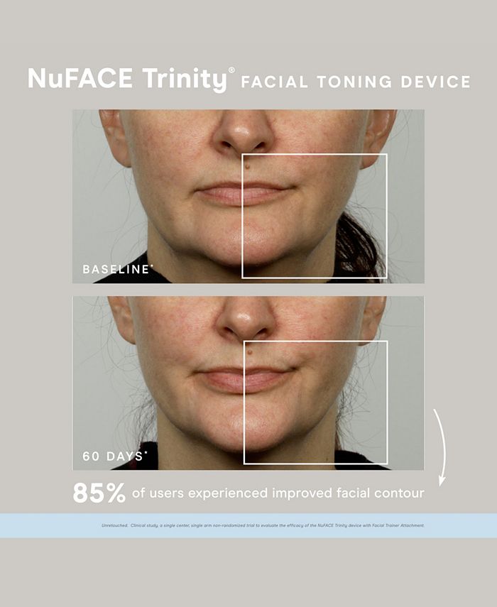 NuFACE Limited-Edition Trinity Microcurrent Skincare Regimen Set - Macy's