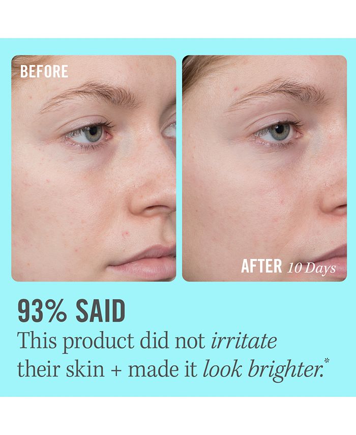 First Aid Beauty 10% Vitamin C Brightening Serum - Macy's
