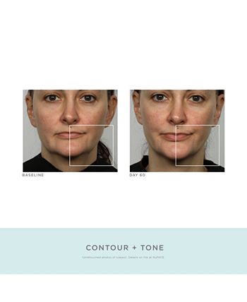 NuFACE 5-Pc. Trinity Supercharged Set - Macy's