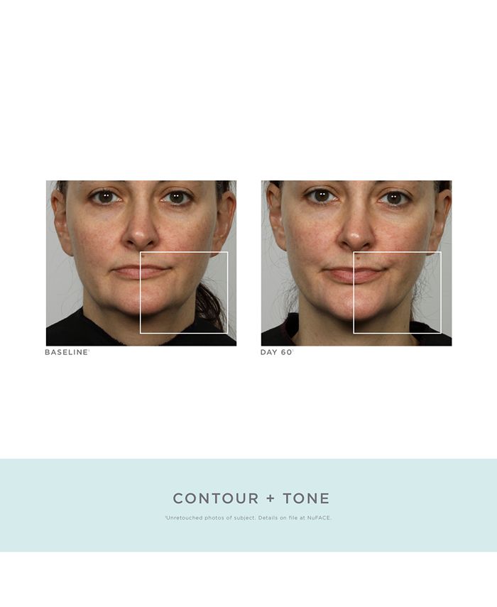 NuFACE 5-Pc. Trinity Supercharged Set - Macy's