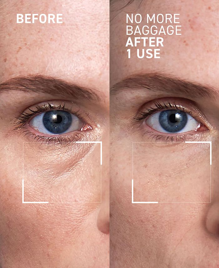 Dr. Brandt Needles No More No More Baggage Eye Gel, 0.5 oz. - Macy's