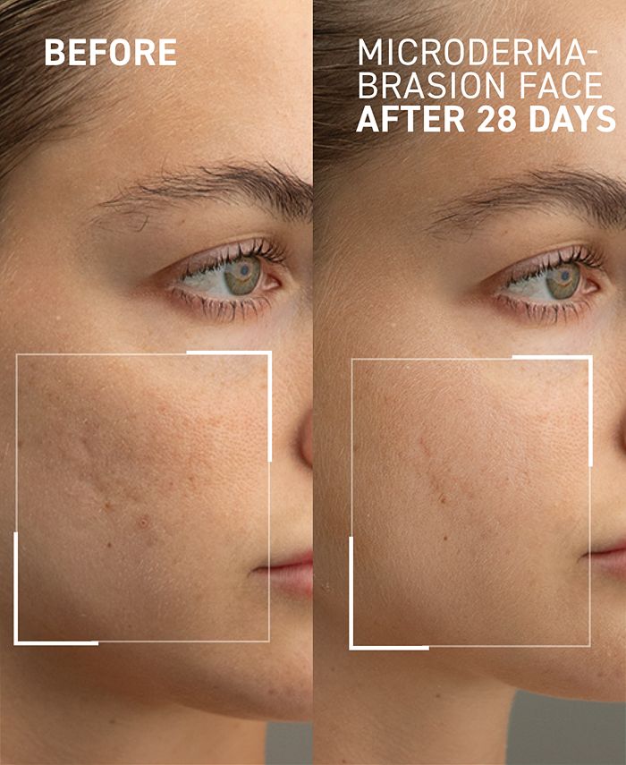 Dr. Brandt Microdermabrasion Renewing Face Exfoliator - Macy's