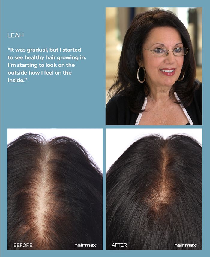 Hairmax Laserband 82 Comfortflex - Macy's