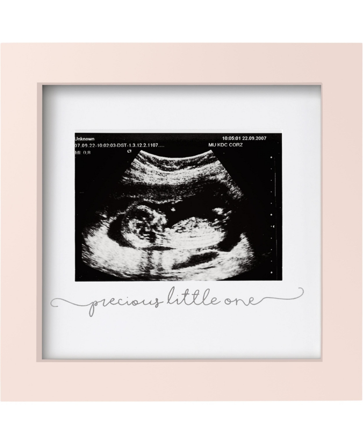 Click here for Solo Baby Sonogram Picture Frame  Modern Ultrasoun... prices