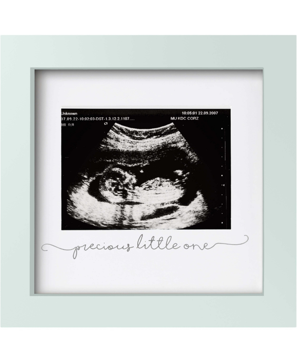 Click here for Solo Baby Sonogram Picture Frame  Modern Ultrasoun... prices
