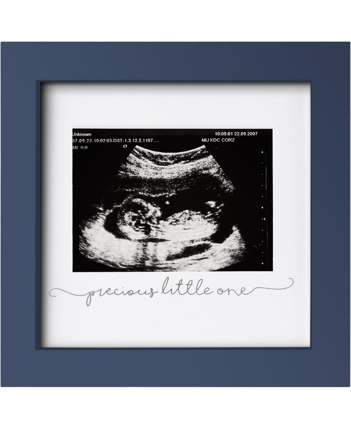 Click here for Solo Baby Sonogram Picture Frame  Modern Ultrasoun... prices