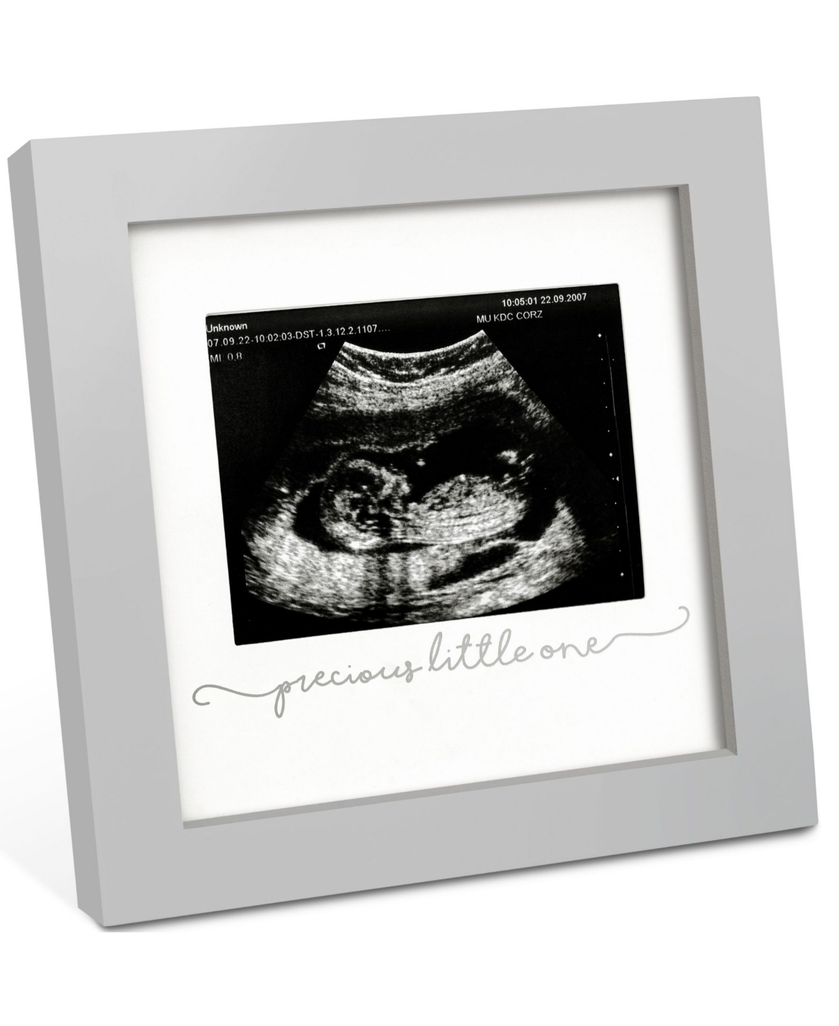 Click here for Solo Baby Sonogram Picture Frame  Modern Ultrasoun... prices