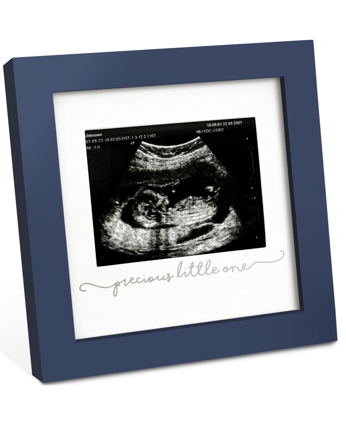 Click here for Solo Baby Sonogram Picture Frame  Modern Ultrasoun... prices