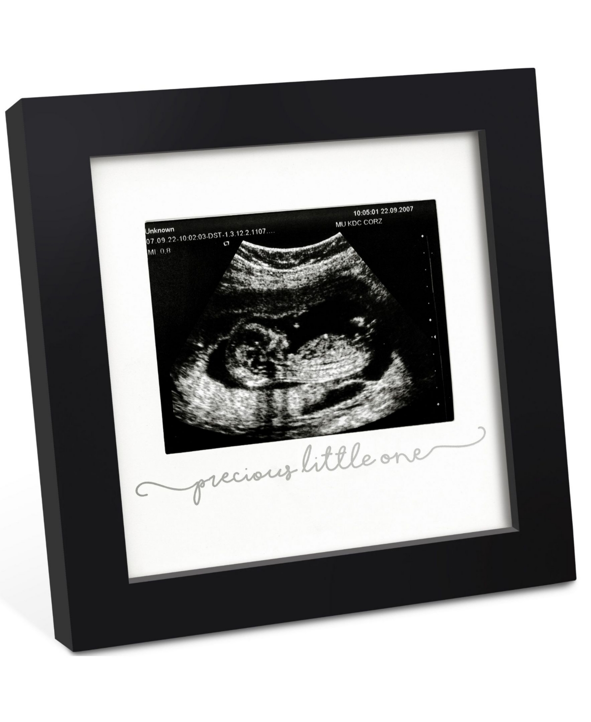 Click here for Solo Baby Sonogram Picture Frame  Modern Ultrasoun... prices