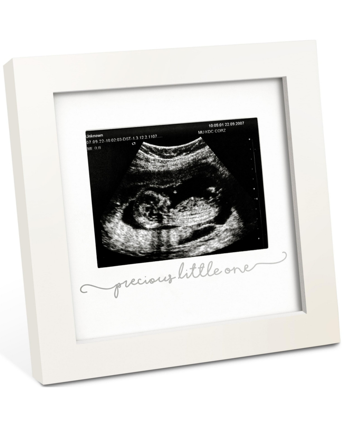 Click here for Solo Baby Sonogram Picture Frame  Modern Ultrasoun... prices