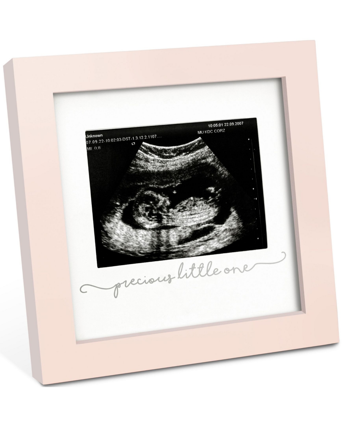 Click here for Solo Baby Sonogram Picture Frame  Modern Ultrasoun... prices