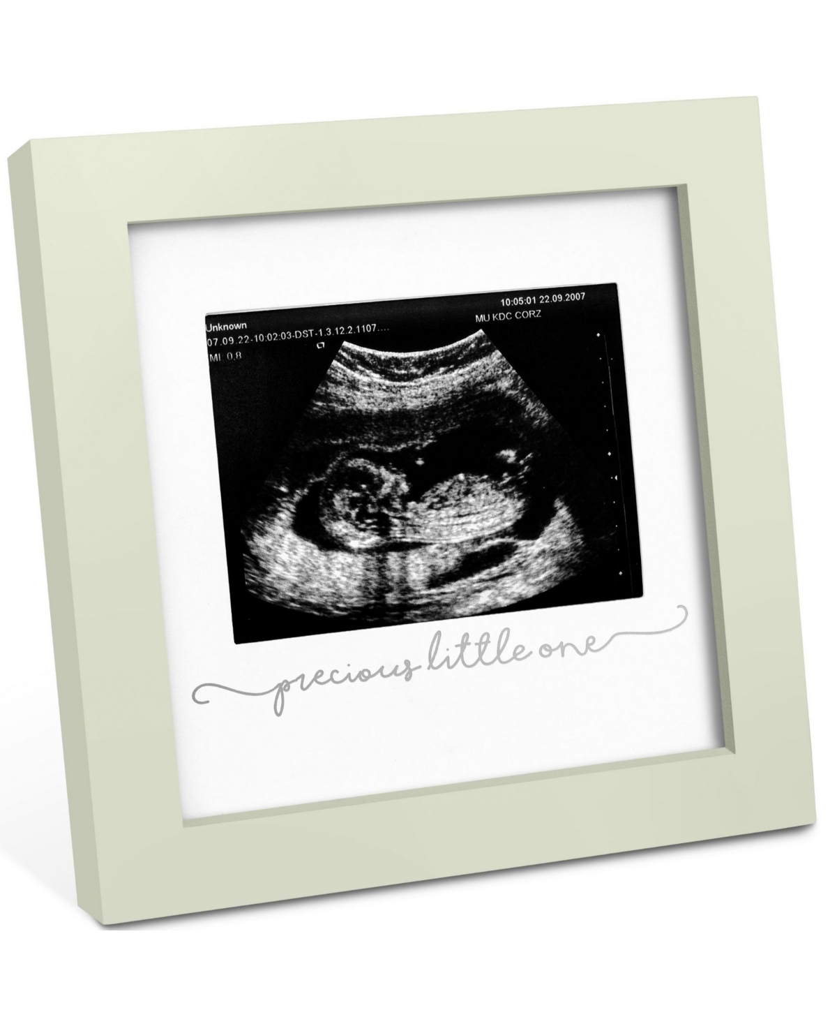 Click here for Solo Baby Sonogram Picture Frame  Modern Ultrasoun... prices