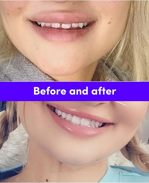 Smile Direct Club New Smile Kit & Reviews - Wellness - Bed & Bath - Macy's