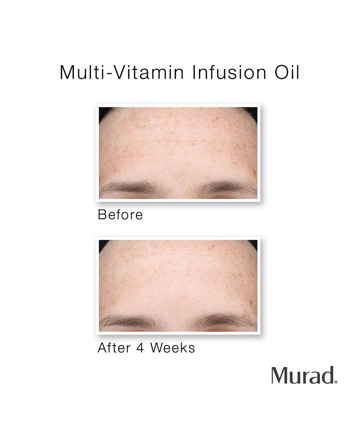 Murad Multi-Vitamin Infusion Oil, 1-oz. - Macy's
