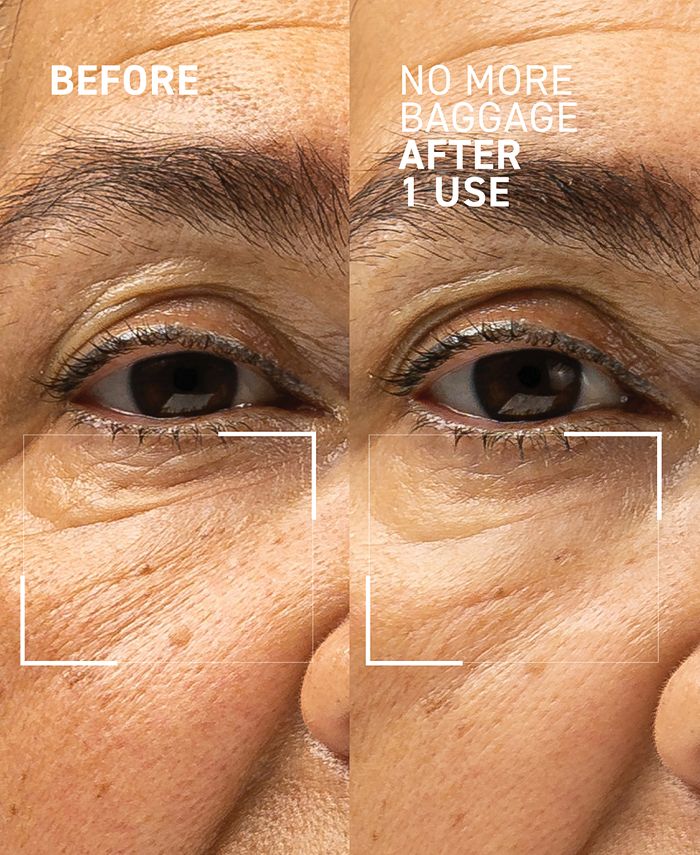 Dr. Brandt Needles No More No More Baggage Eye Gel, 0.5 oz. - Macy's